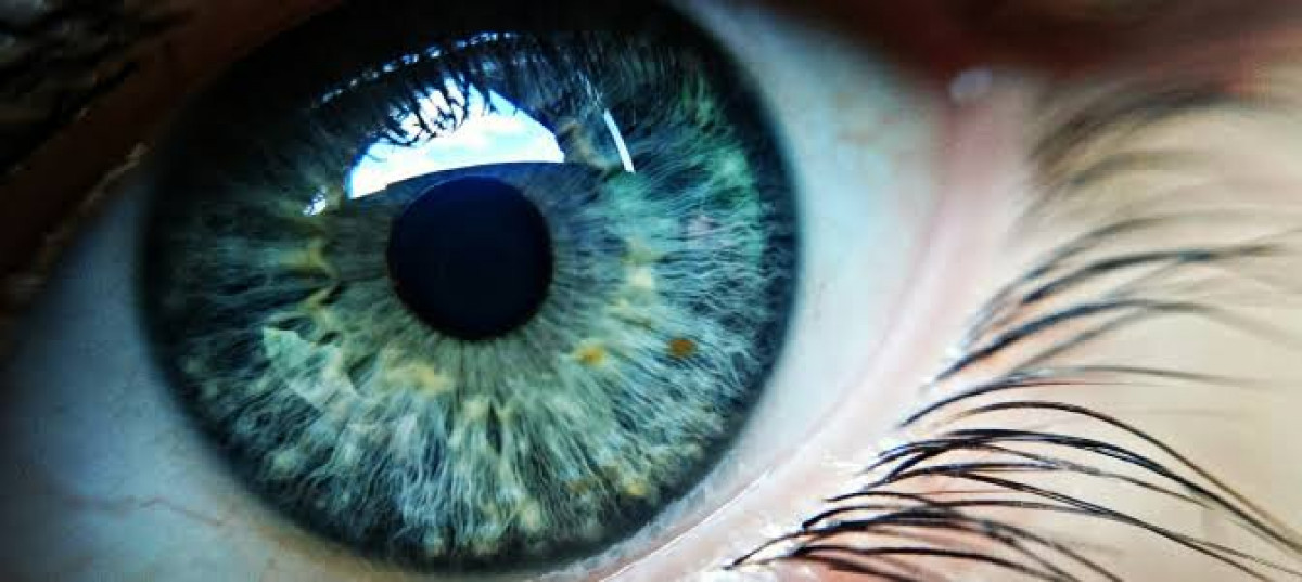 Gözde arpacık nasıl geçer? - Sağlık | Fit Olsam