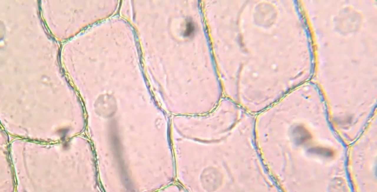 Epitel hücre nedir? Epitel hücre düşüklüğü hangi hastalıkların ...